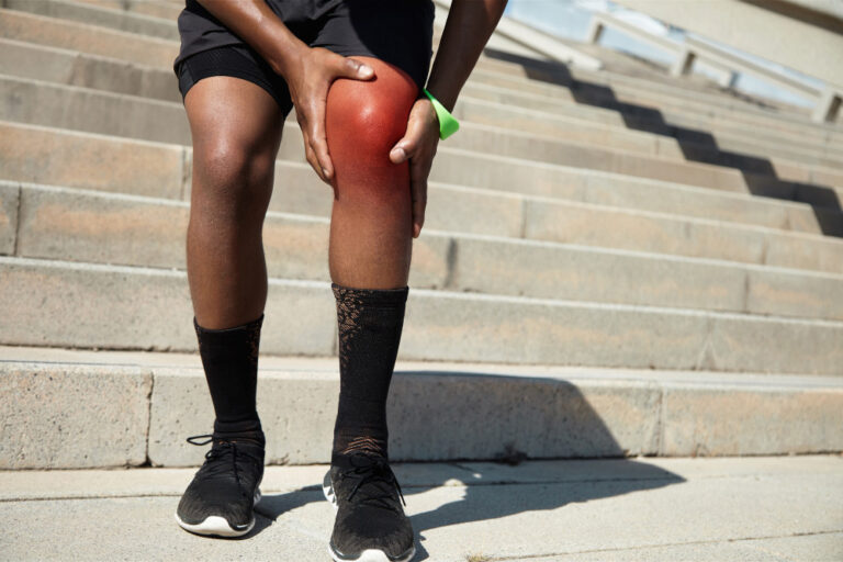 Patella Dislocation Explained: A Comprehensive Guide to Symptoms and ...